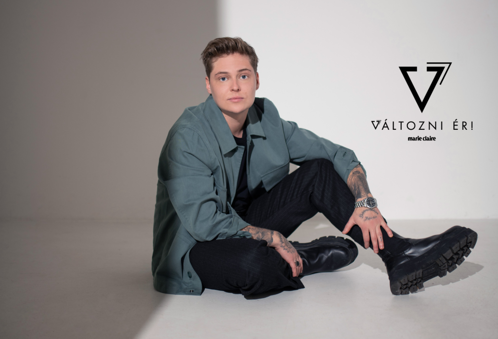 Széles Adrienn: „Belehabarodtam a foltjaimba!”